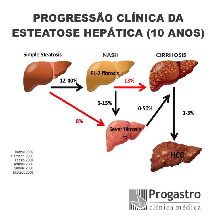 O que é “Esteatose Hepática”? – Instituto PROGASTRO