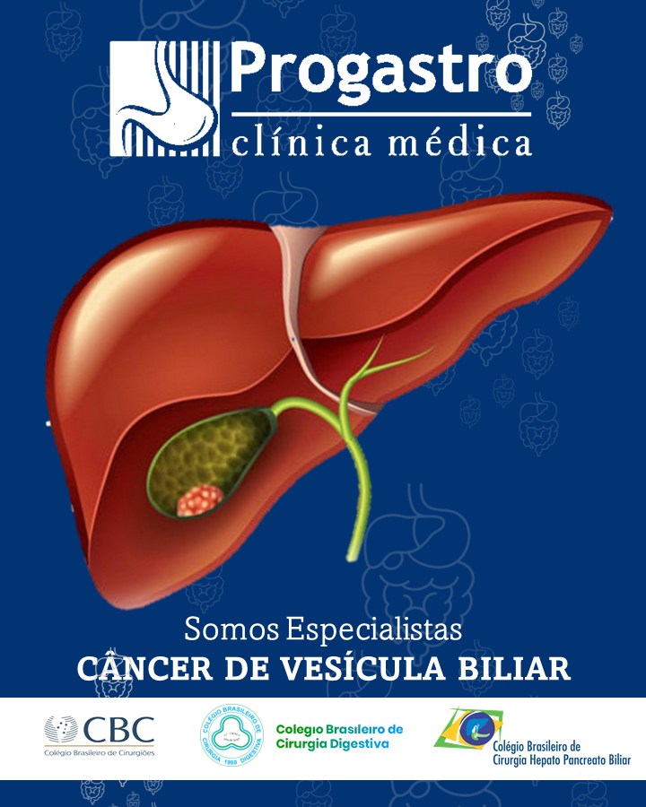 Pólipo da Vesícula Biliar – Instituto PROGASTRO